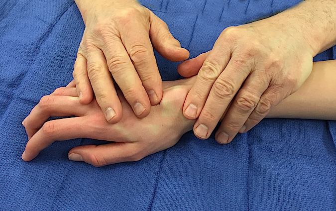 Mass: Mobility, Size, Tenderness, Texture | Hand Surgery Resource